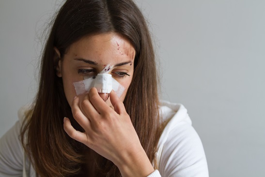 How to Recover From a Truck Accident Facial Injury - Max Meyers Law PLLC